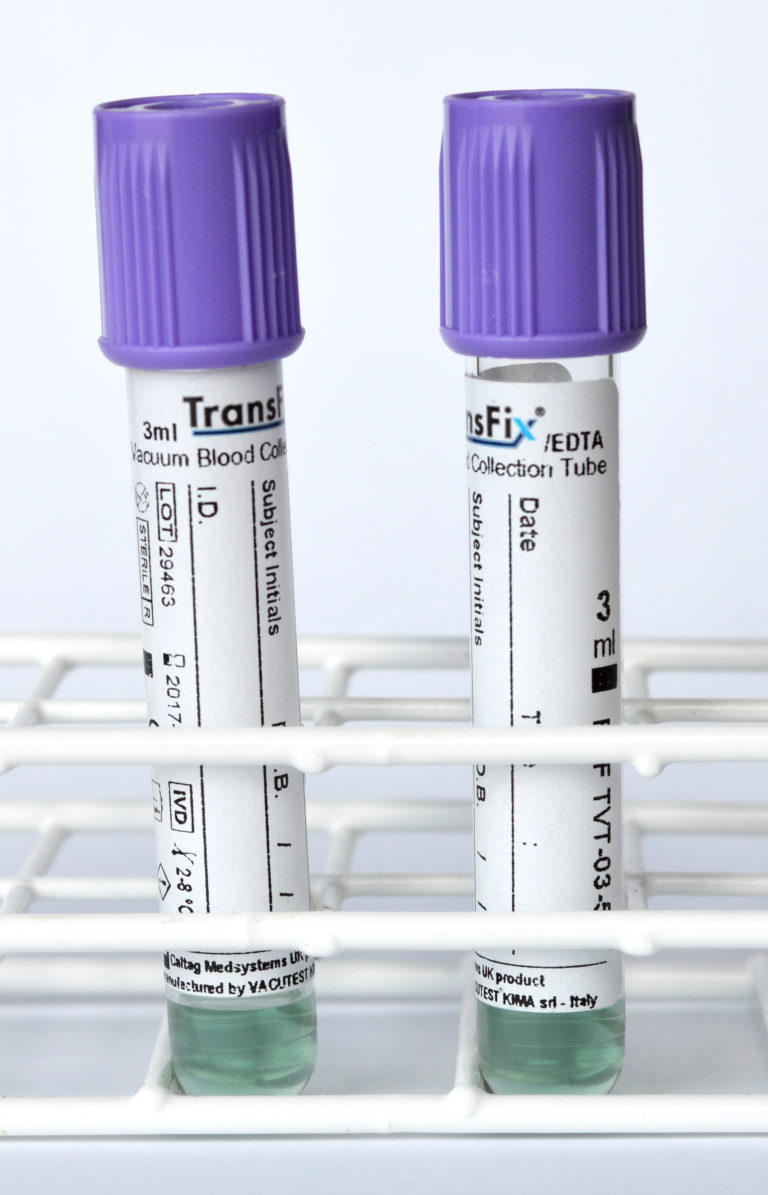 New Research demonstrates the benefits of TransFix®/EDTA Vacuum Blood ...