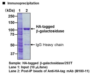 HA-tags: Better Understanding of Localisation, Expression and ...