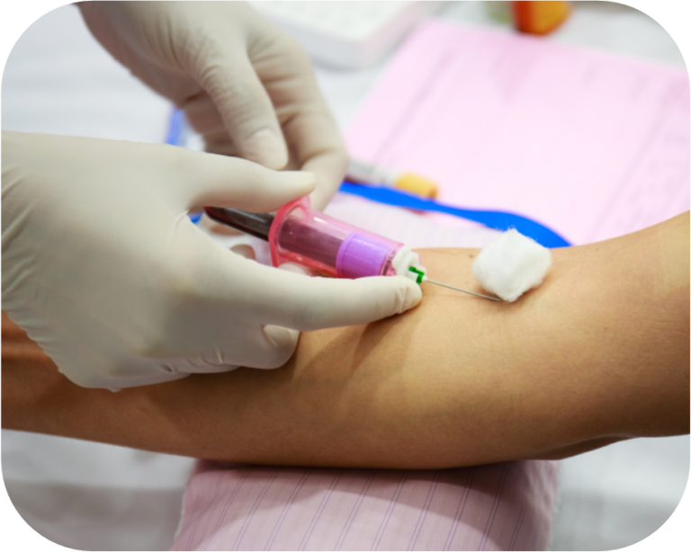 TransFix: A Cellular Antigen Stabilisation Reagent – Caltag Medsystems